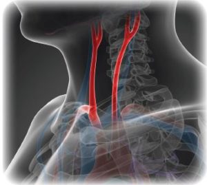Fortbildung: Die Halsschlagader im Fokus - Klinikum Fulda