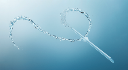 Glaukomchirurgie - Moderne minimalinvasive Glaukomchirurgie - Klinikum ...